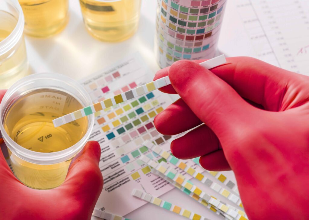 The Whizzinator: 2024's Game-Changer For Discreet Convenience