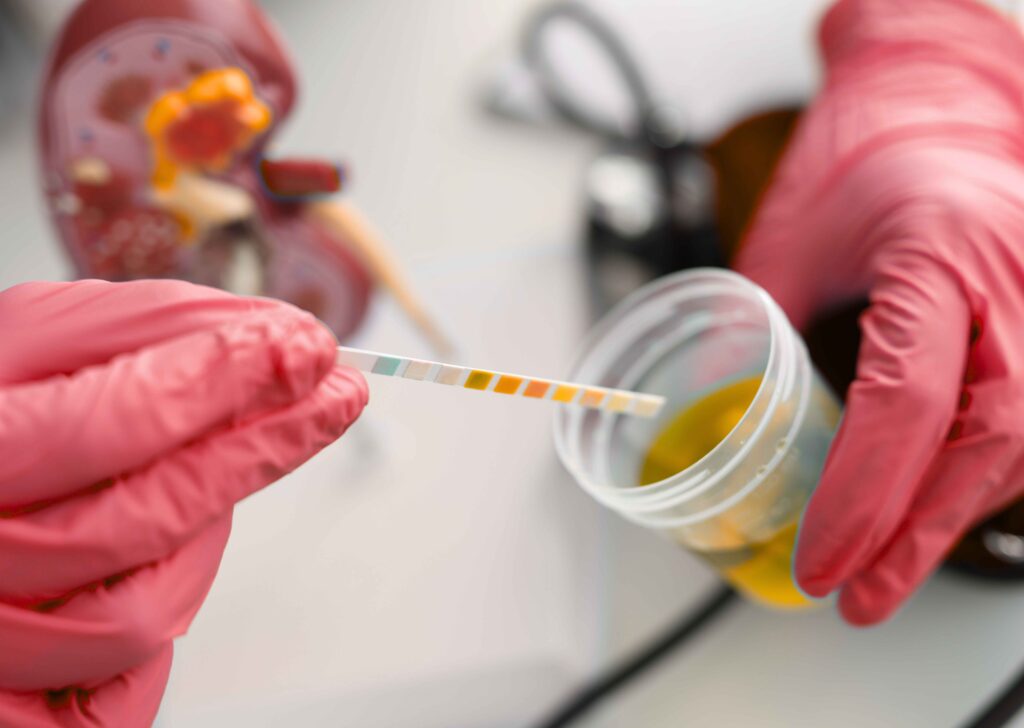 The Ultimate Guide To Golden Flask By Whizzinator: 2024’s Top Synthetic ...