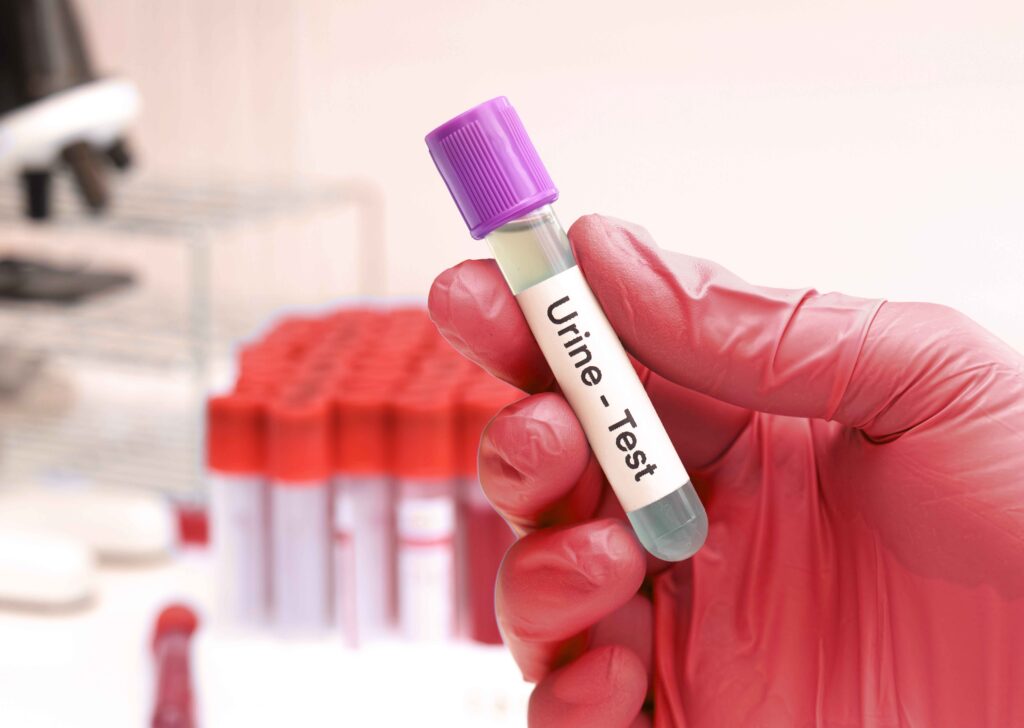 The Real Science Behind Synthetic Urine | Whizzinator